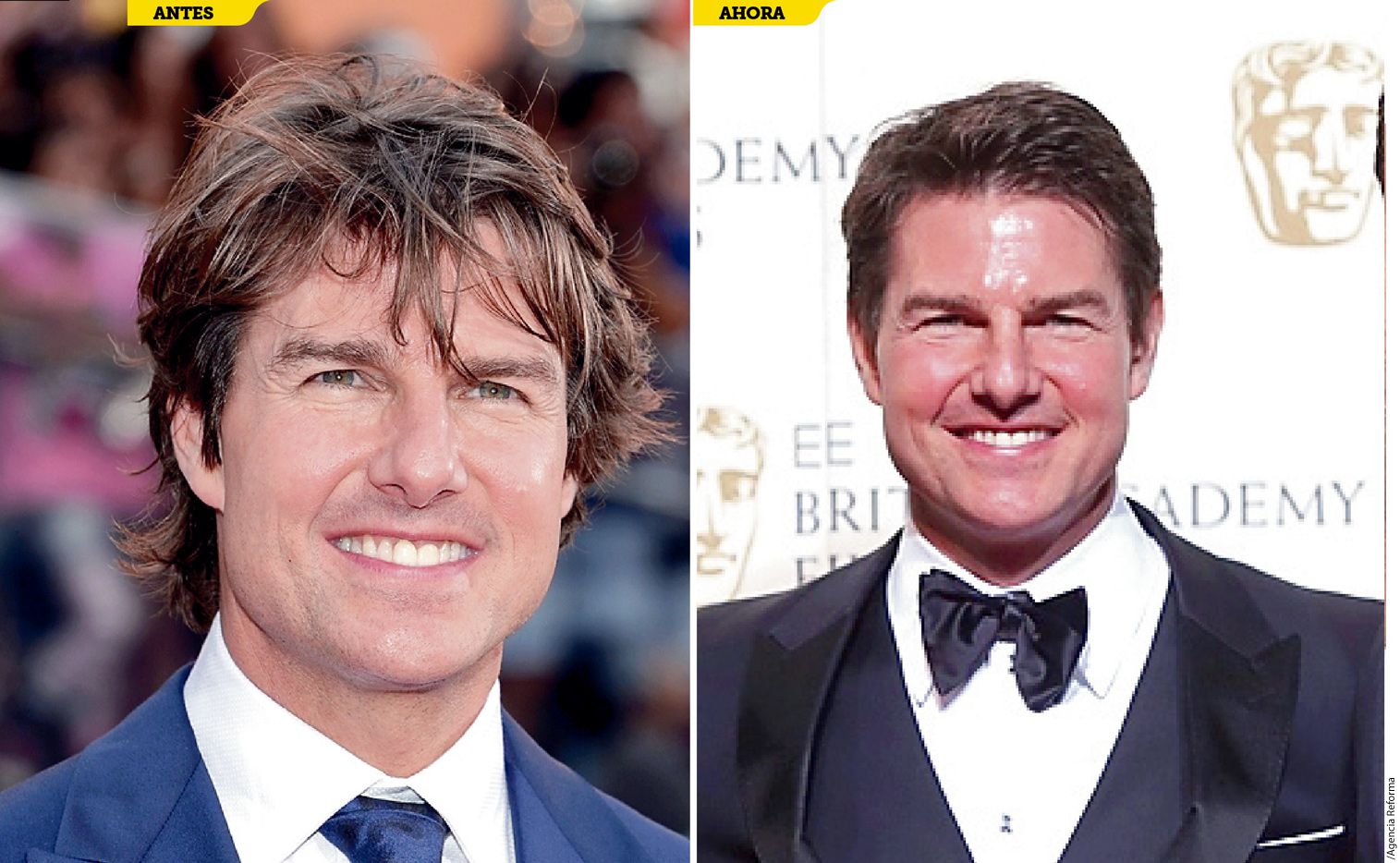 Luis Miguel, Zac Efron y otros hombres que se han inyectado bótox