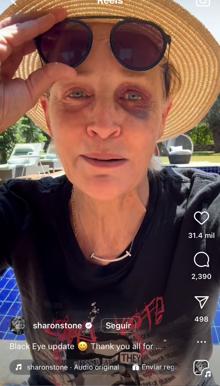 Sharon Stone revela cómo llegó a tener un ojo morado | Grazia México y ...