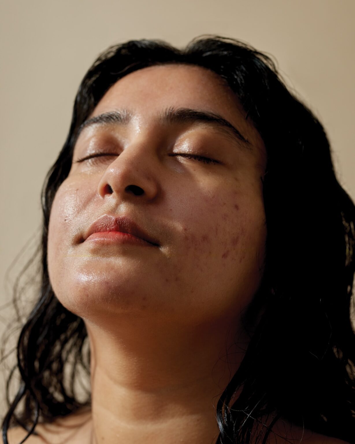 Skin Laundry Laser Facial Review: Fast, Painless, & Effective